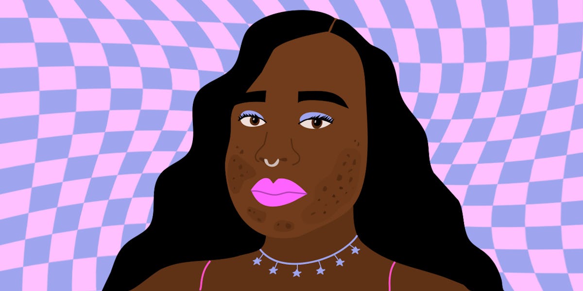 Everything You Need To Know About Hyperpigmentation