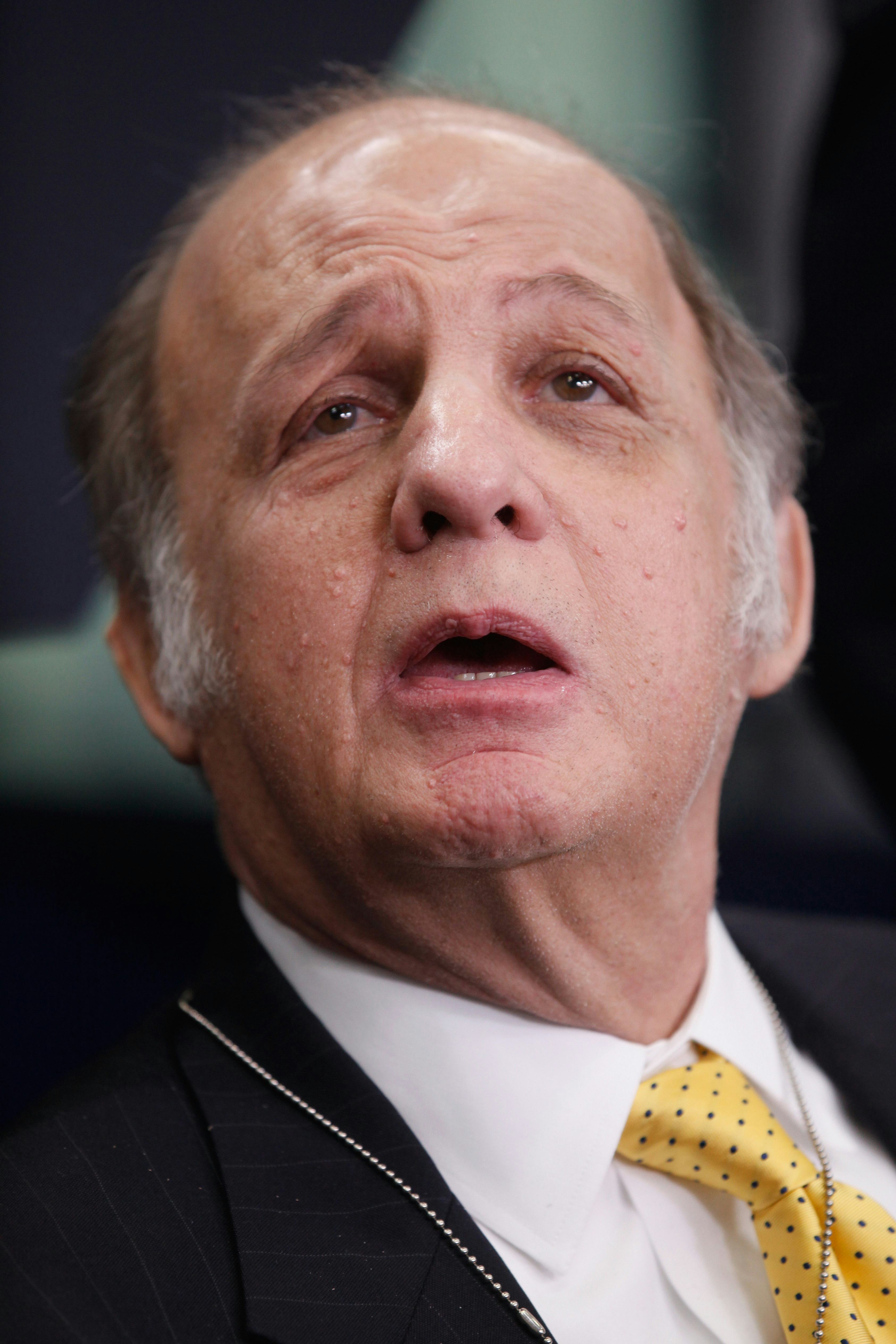 Gun Control Icon James Brady Is Dead, After 33 Years Of Fighting For ...