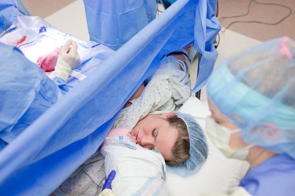 Hey Mama, You Can Feel Proud Of Your C-Section Too