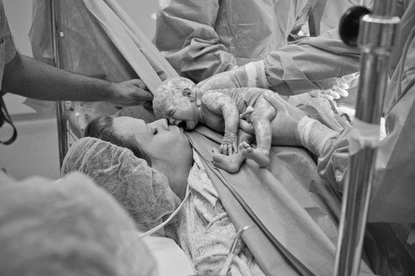 Hey Mama, You Can Feel Proud Of Your C-Section Too