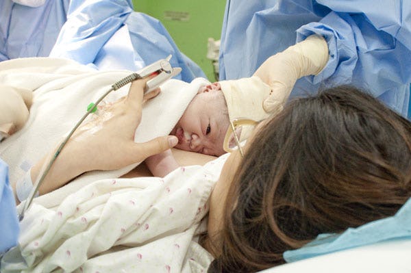 I Delivered My Placenta Before My Baby