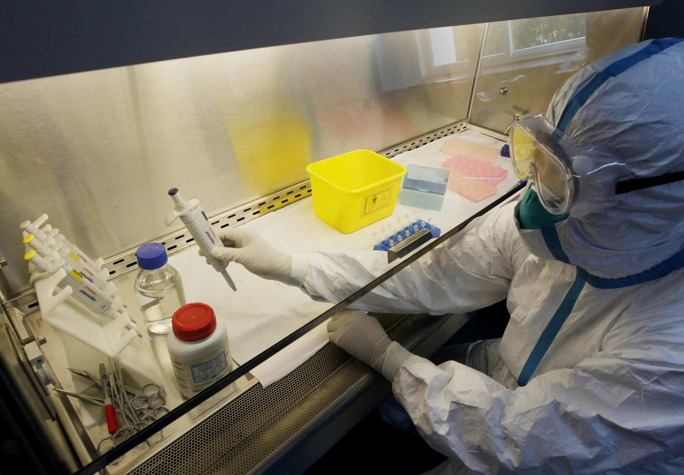 How Does Mono Affect The Body? Epstein-Barr Virus Was Linked To Other ...