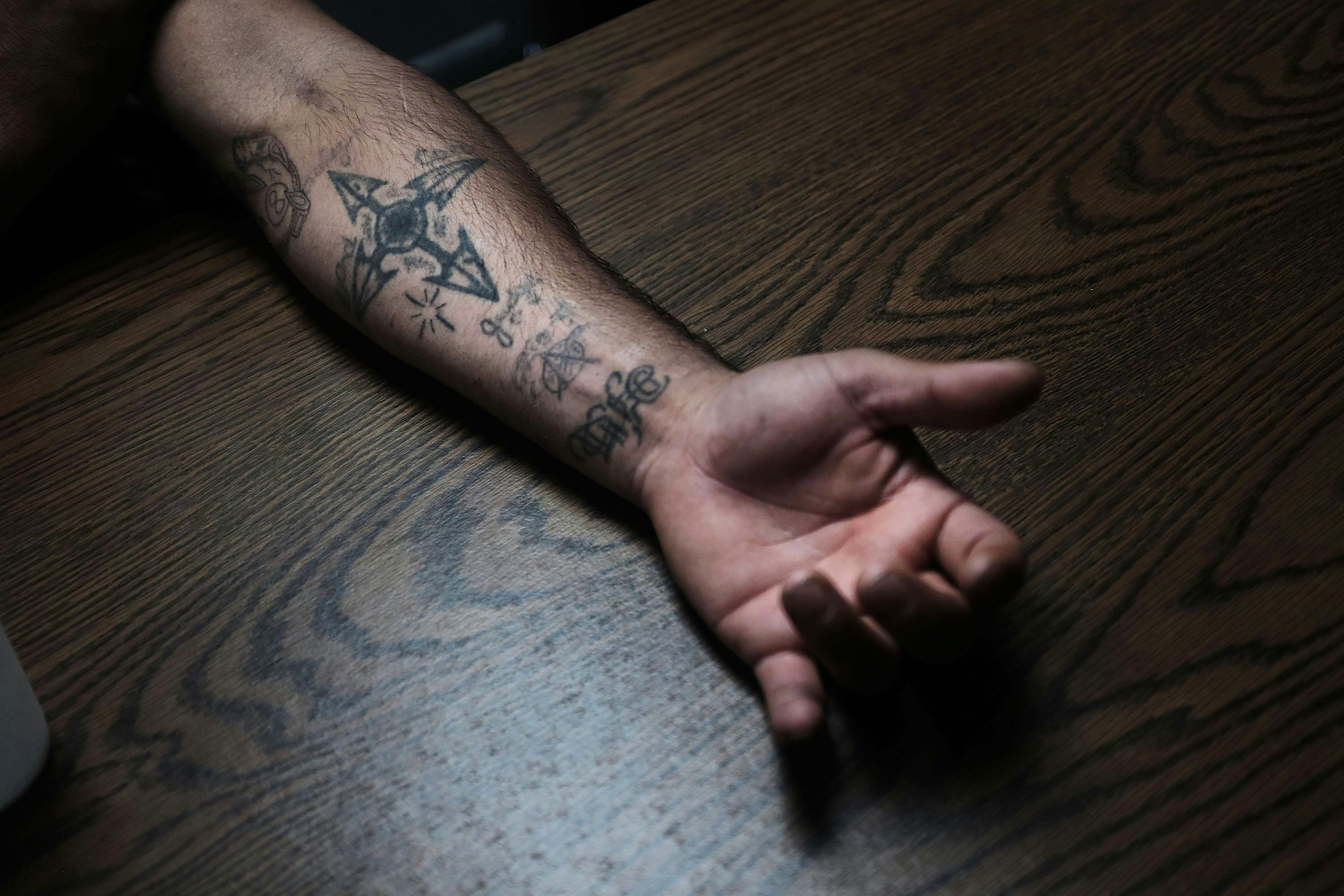 How Do You Get A Tattoo Removed? Here's Exactly How The Process Works