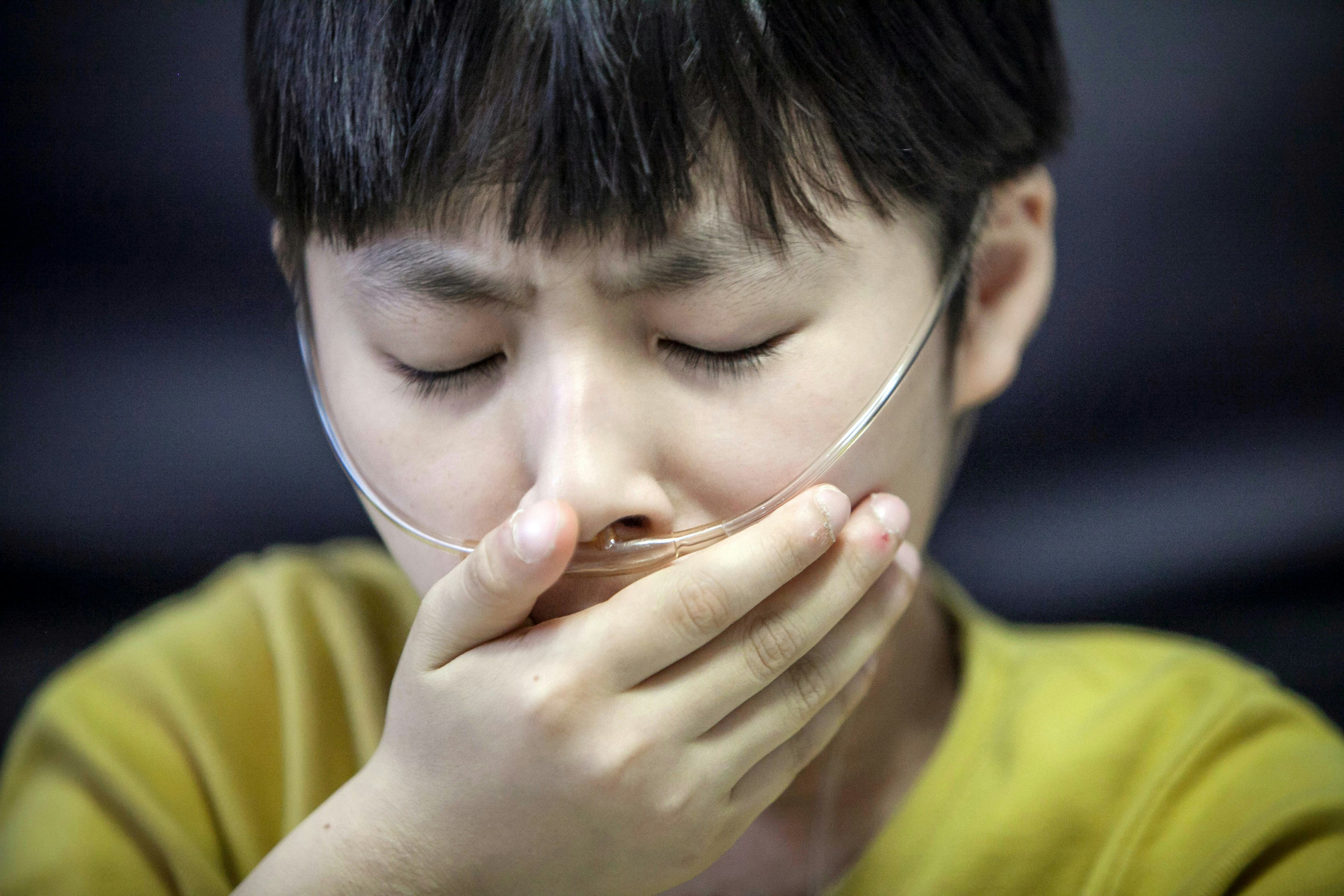 5 Signs & Symptoms Of Measles That You Shouldn’t Ignore, According To ...