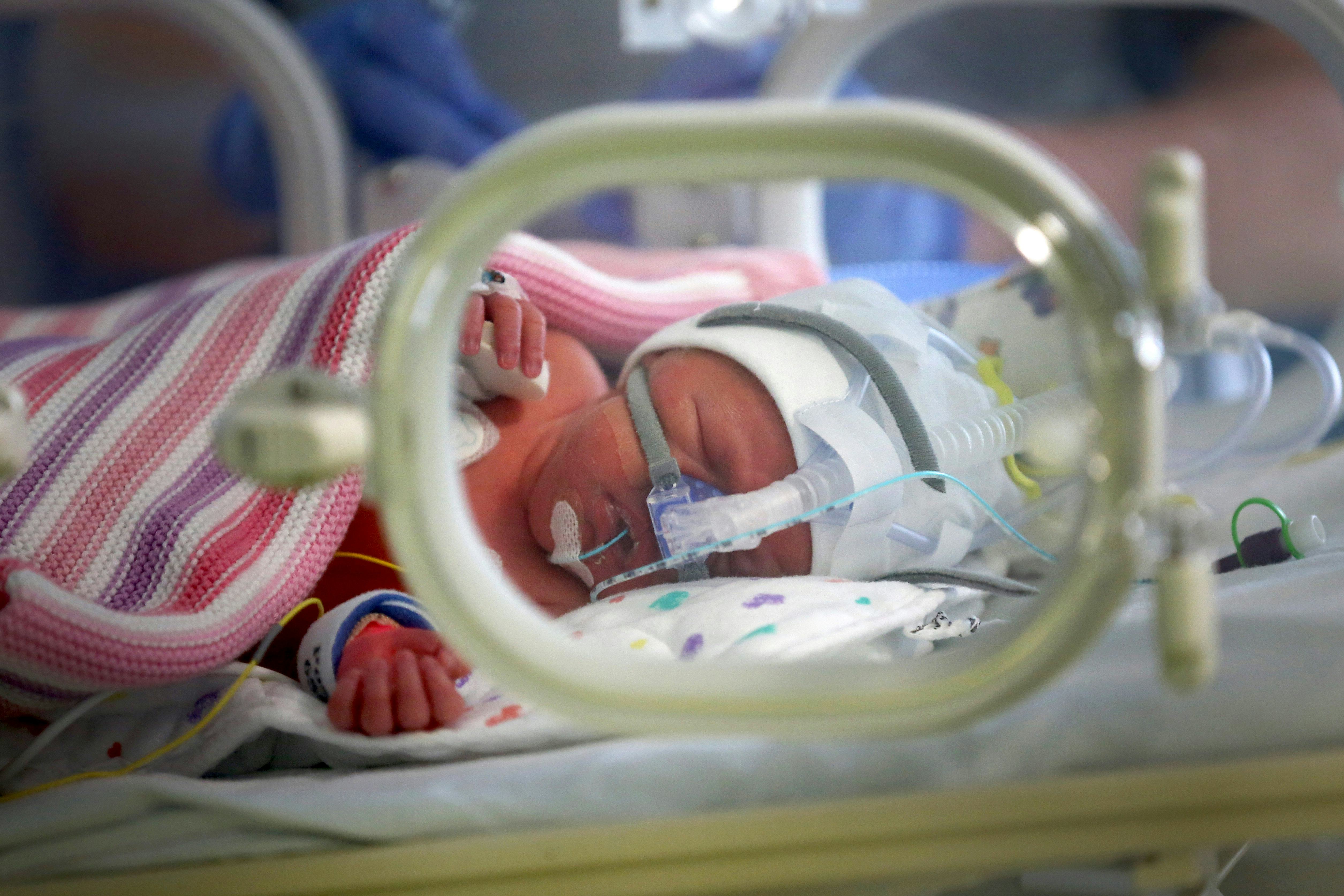 The Average Time Babies Spend In The NICU & Why It Matters