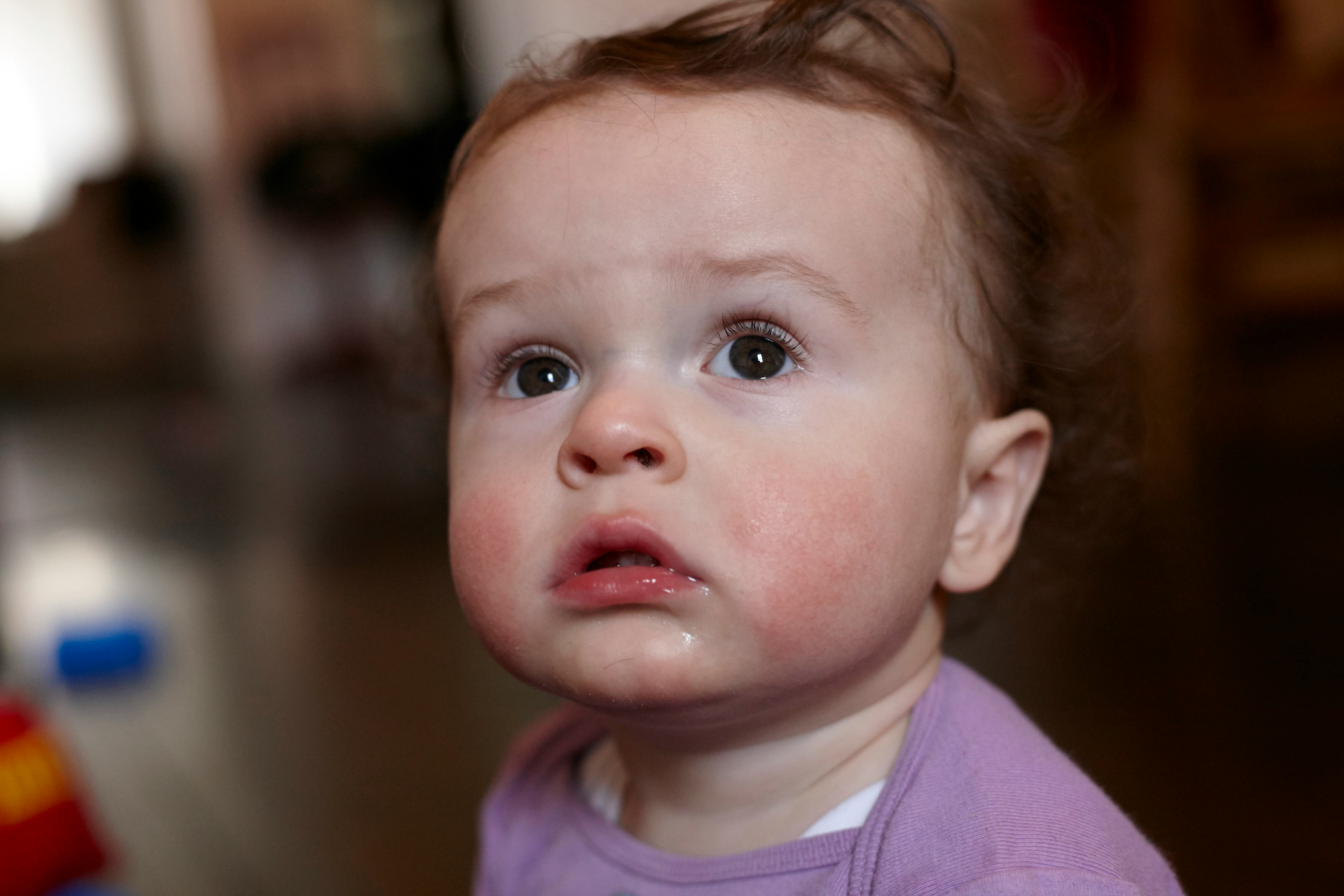 How To Treat Drool Rash, Because You Just Can't Stop The Slobber