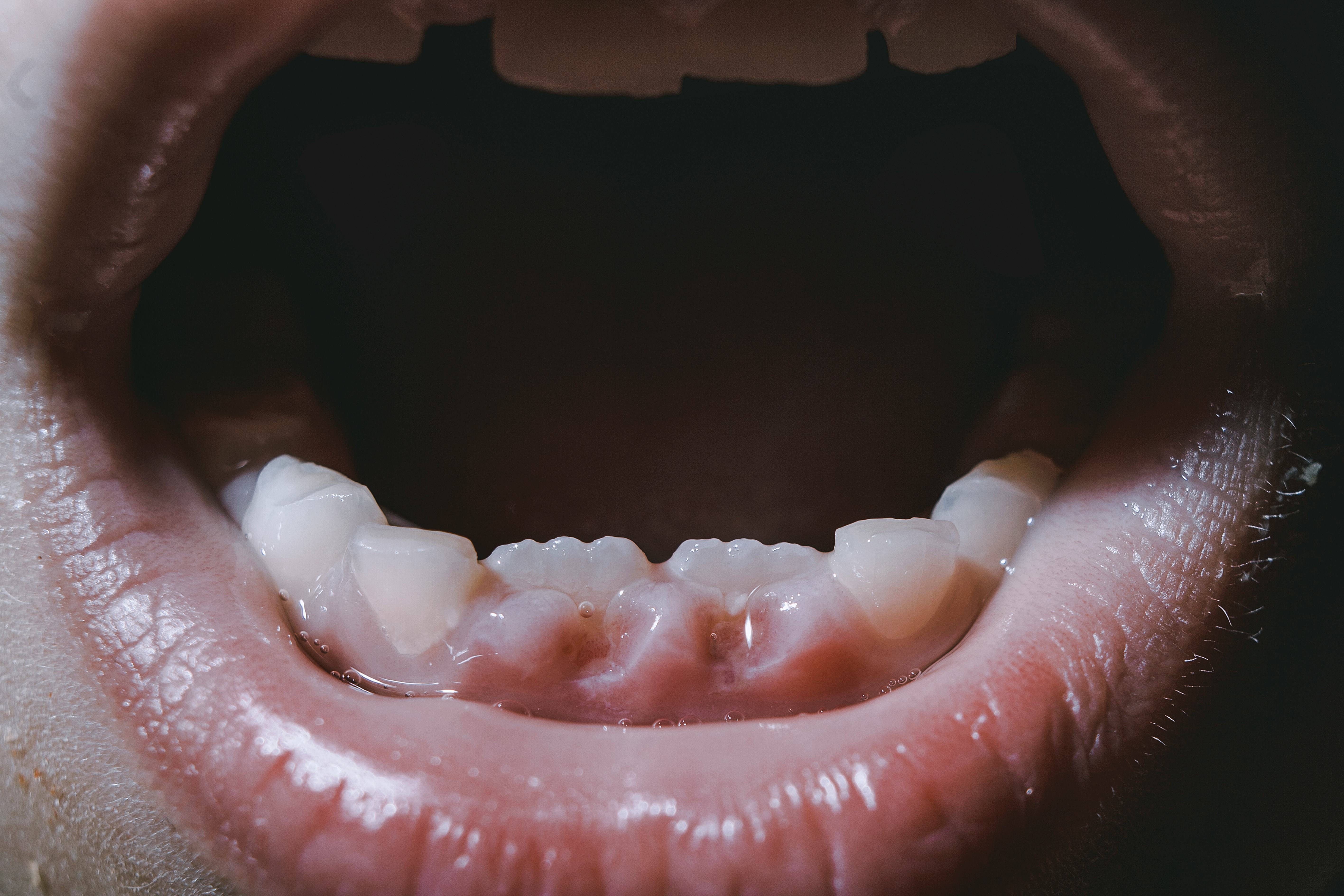 Look: Ancient teeth hints at a similarity between Neanderthal and human ...