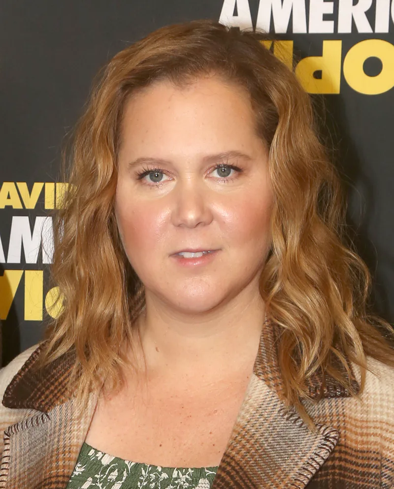 Amy Schumer Opened Up About Having A Bad Experience With Fillers