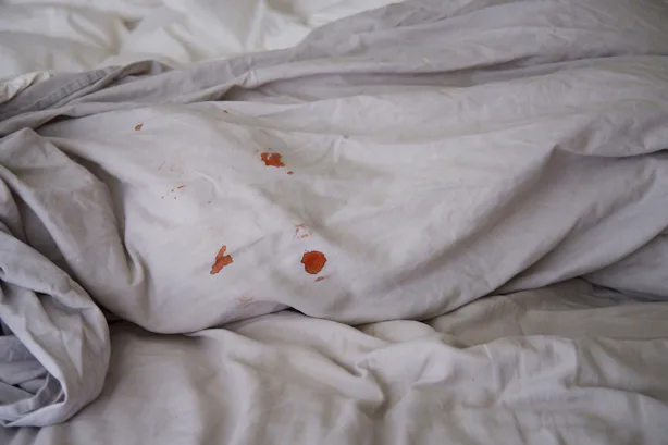 11 Reasons For Bleeding During Or After Sex, Explained By Experts