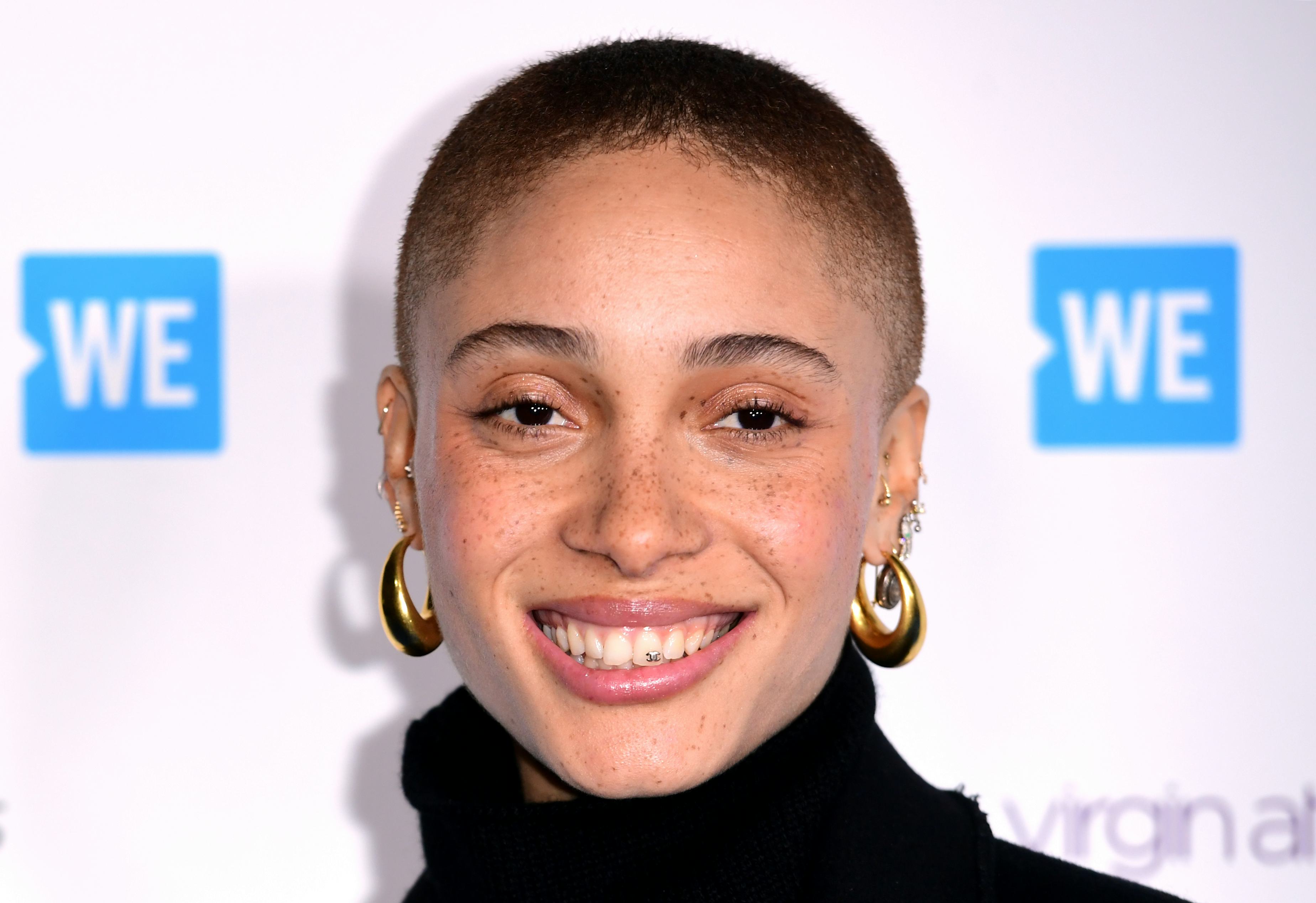 Tooth Piercings & Gems: How They Work & How Long They Last