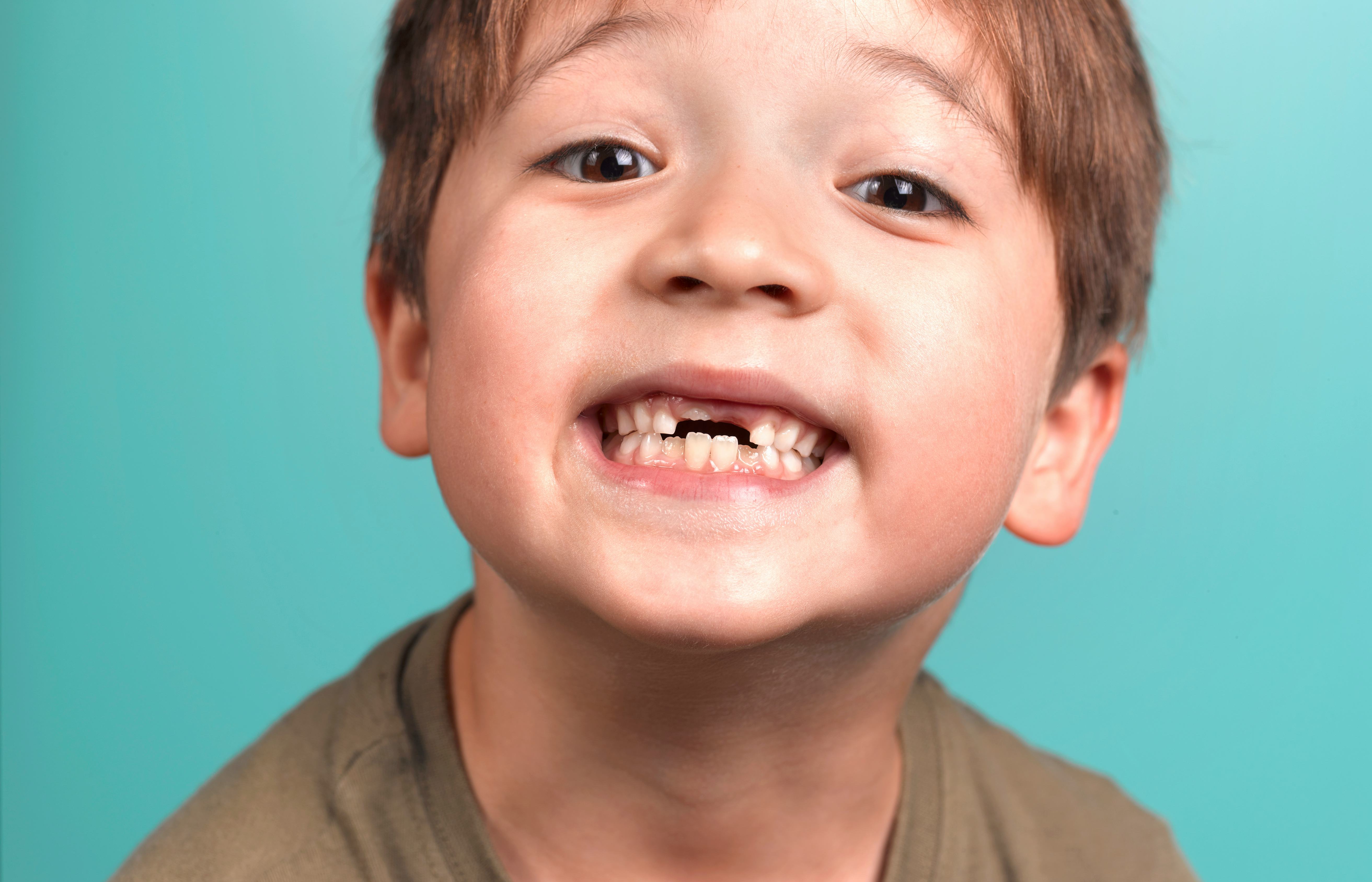 When The Class Biter Is Your Son