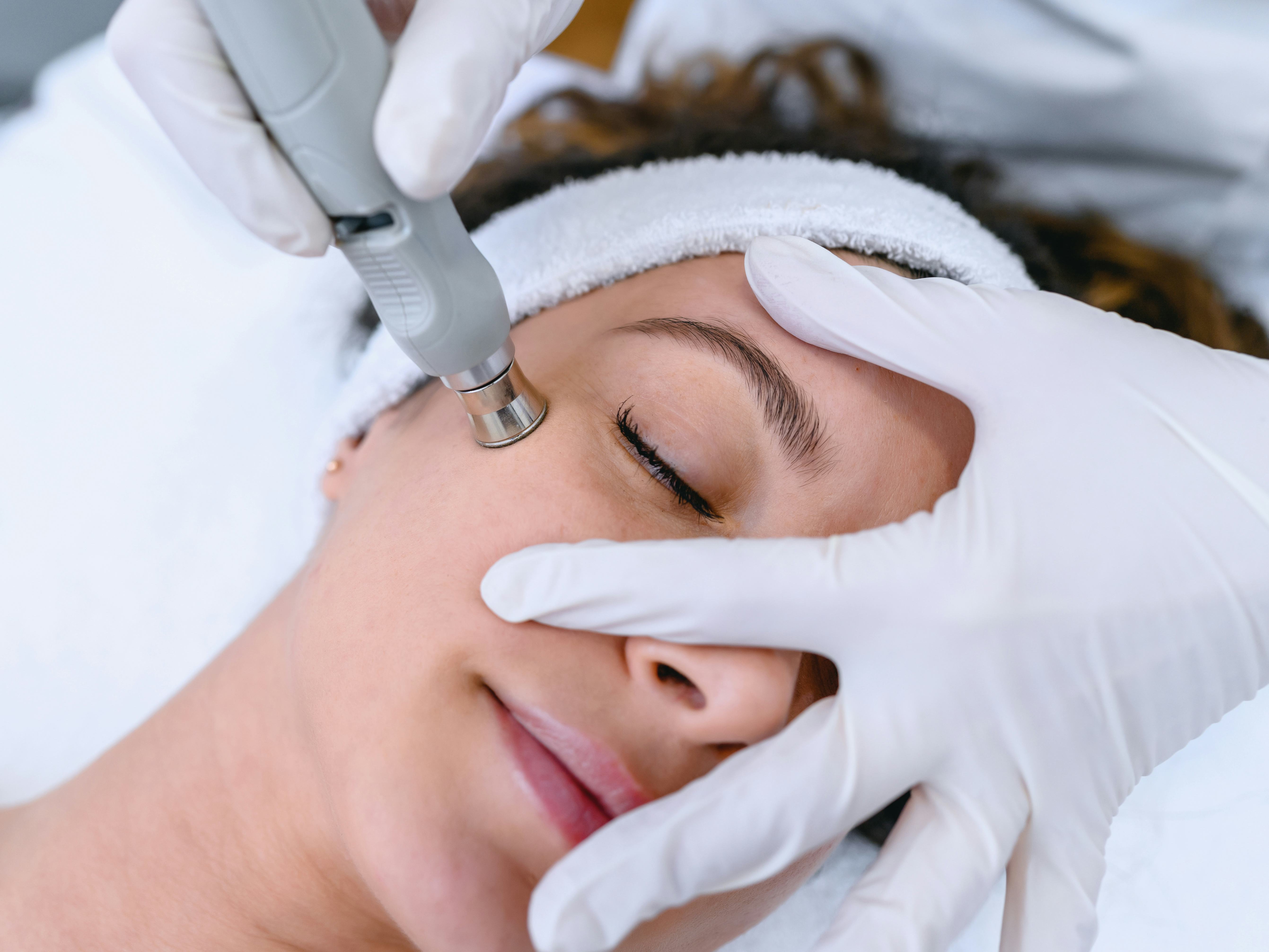 How To Get Rid Of Milia At Home & With A Dermatologist