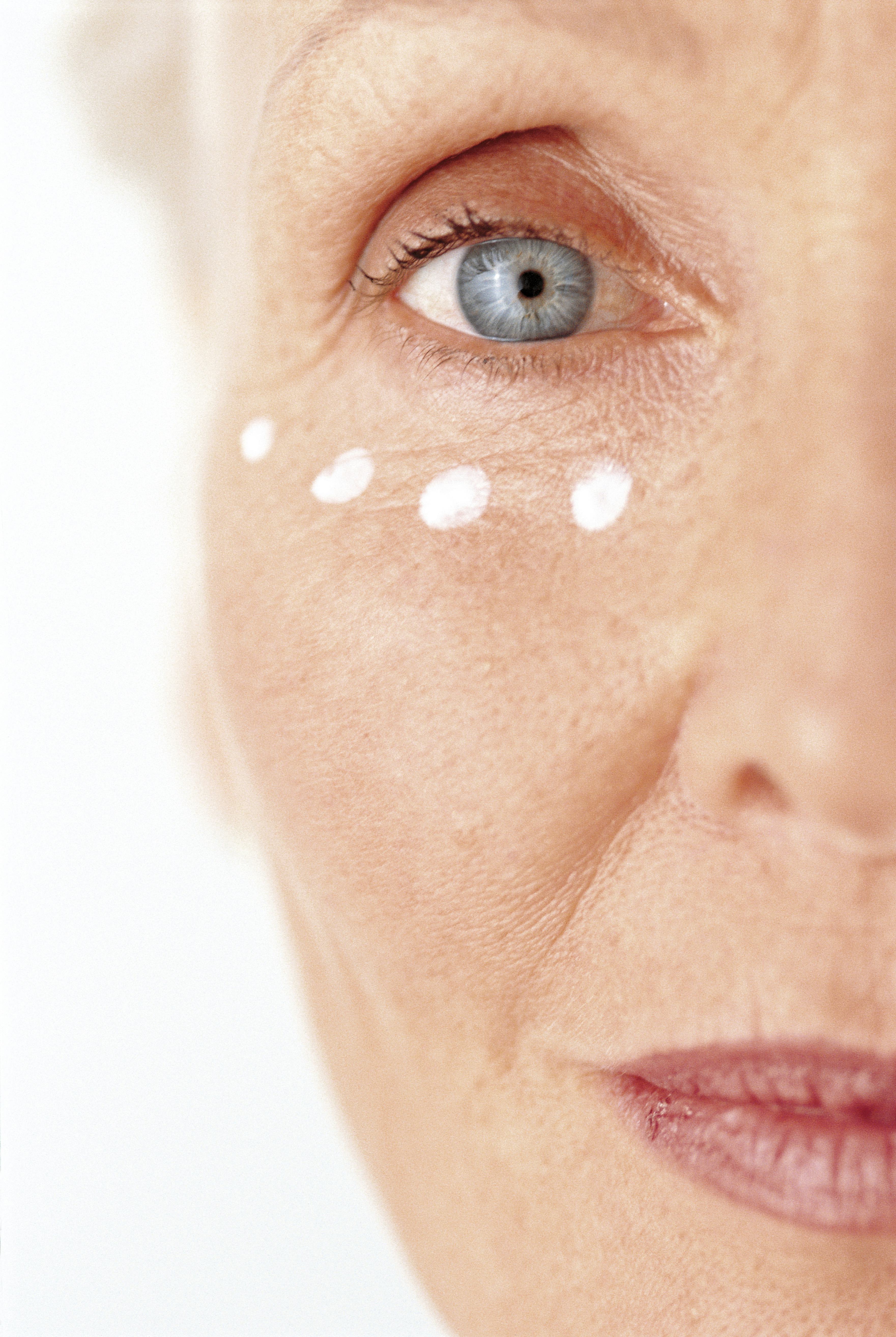 Fat Transfer For Under-Eyes: Is It A Better Option Than Under-Eye Filler?