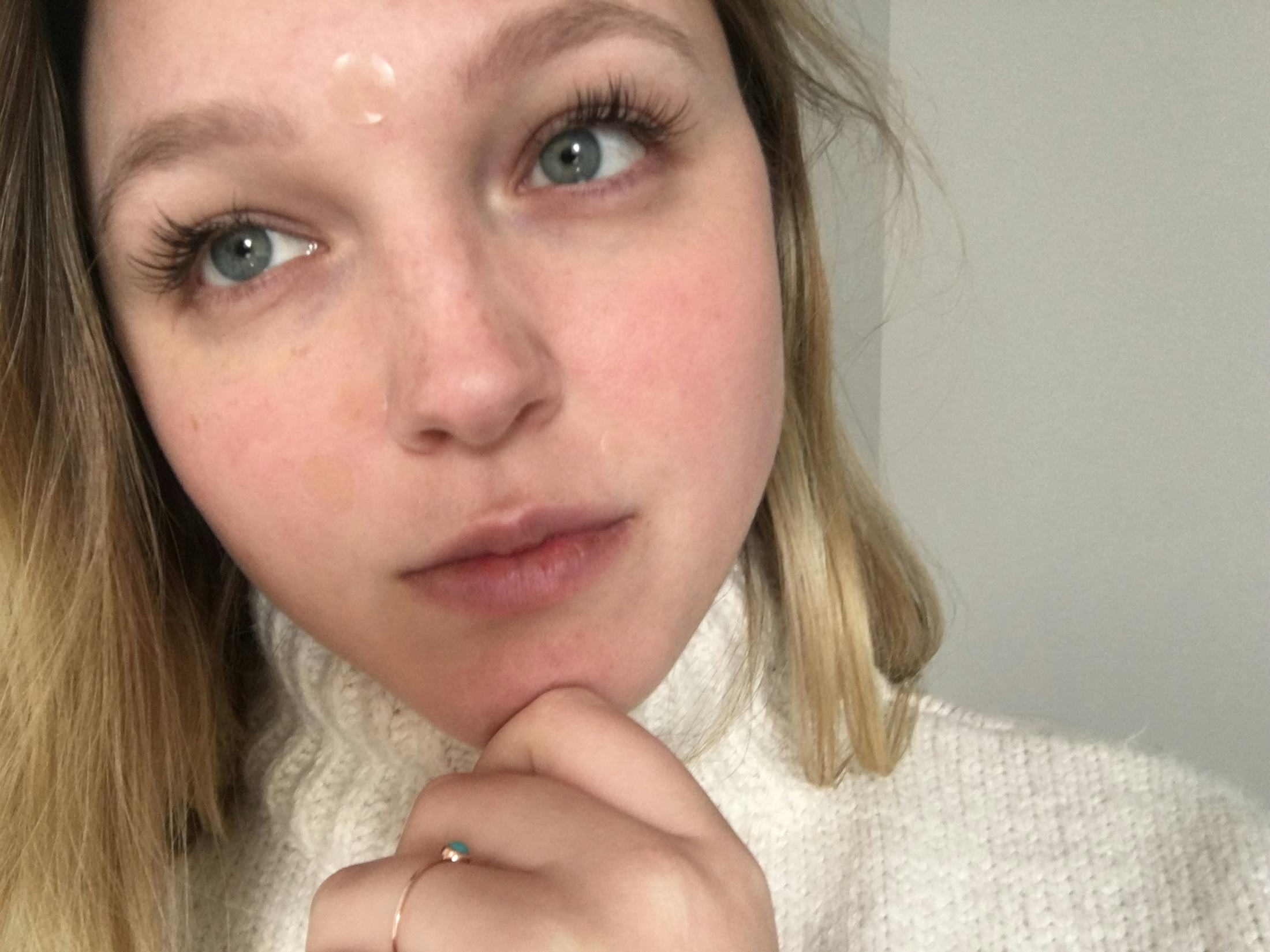 Do Acne Stickers Work? These Korean Beauty Acne Dots Are My Best Friend