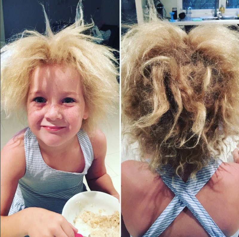 Uncombable Hair Syndrome Is A Thing That Actually Exists & It Sounds ...