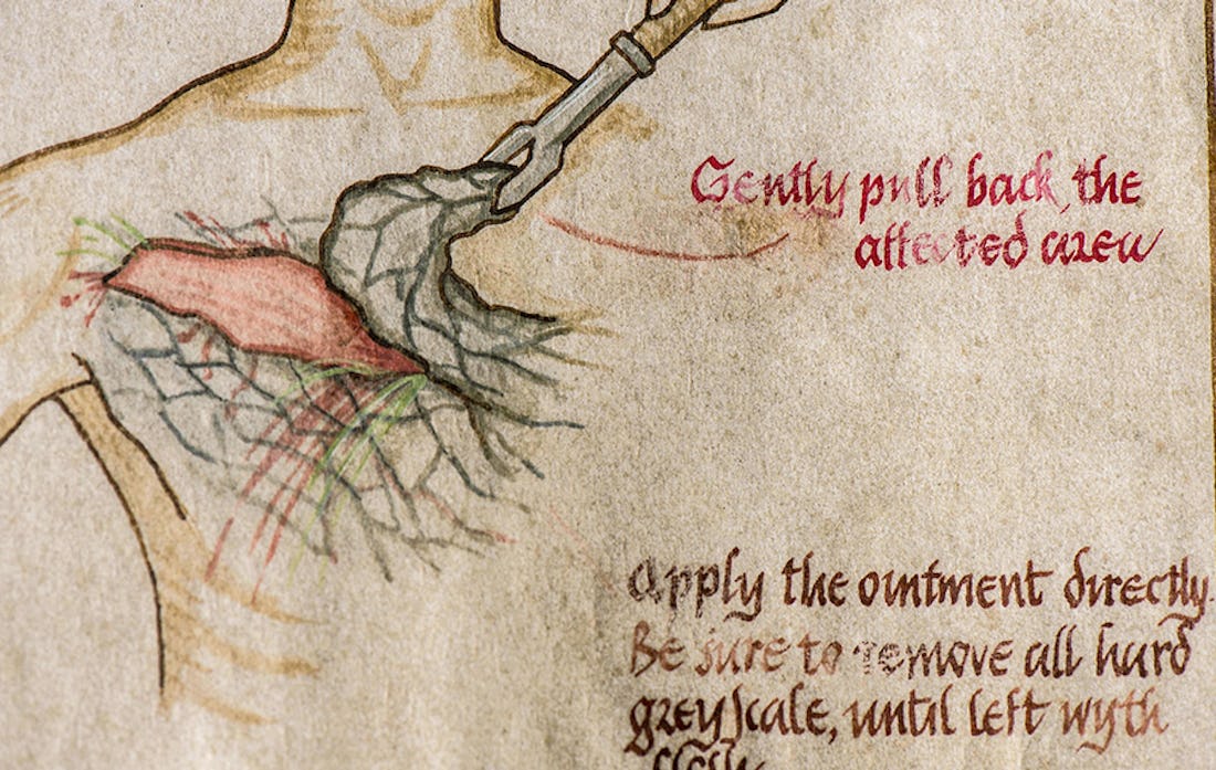 How Did Sam Cure Jorah On 'Game Of Thrones?' Greyscale Is No Match For ...