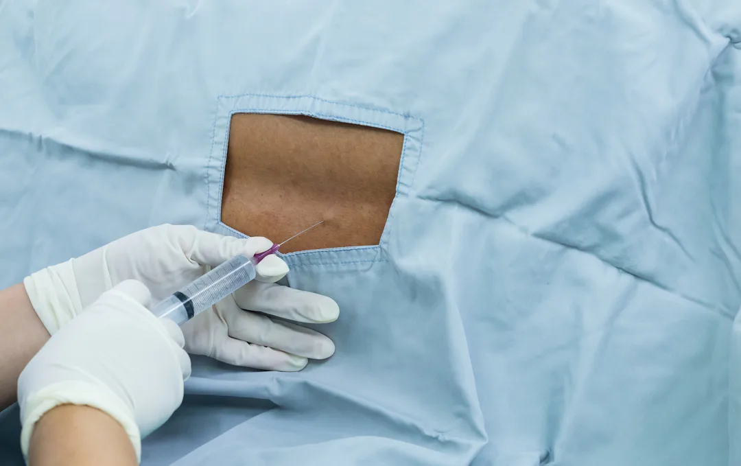 What You Need To Know About A Spinal Block Versus An Epidural ...