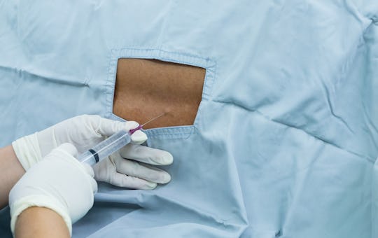 What You Need To Know About A Spinal Block Versus An Epidural ...