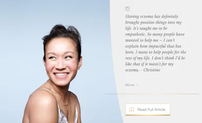 Dove's Make Peace With Dry Skin Campaign Puts People With Skin ...
