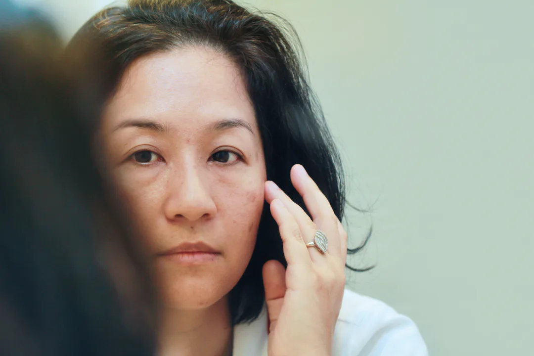 15 Subtle Changes To Your Face That Can Be A Sign Of A Health Problem