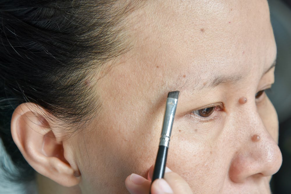 15 Subtle Changes To Your Face That Can Be A Sign Of A Health Problem