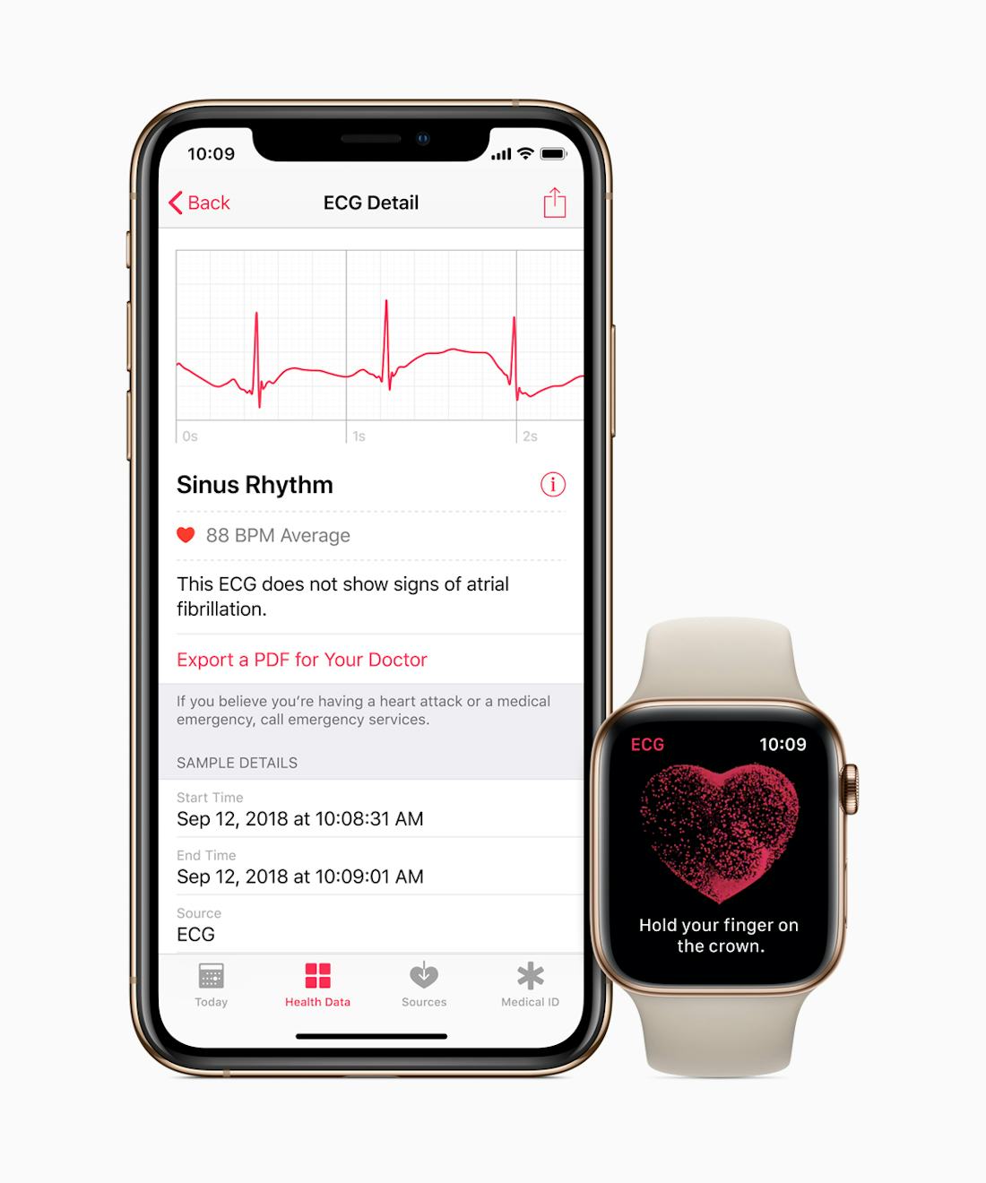 The Apple Watch Heart Monitor Is Here & This Is What It Can Do
