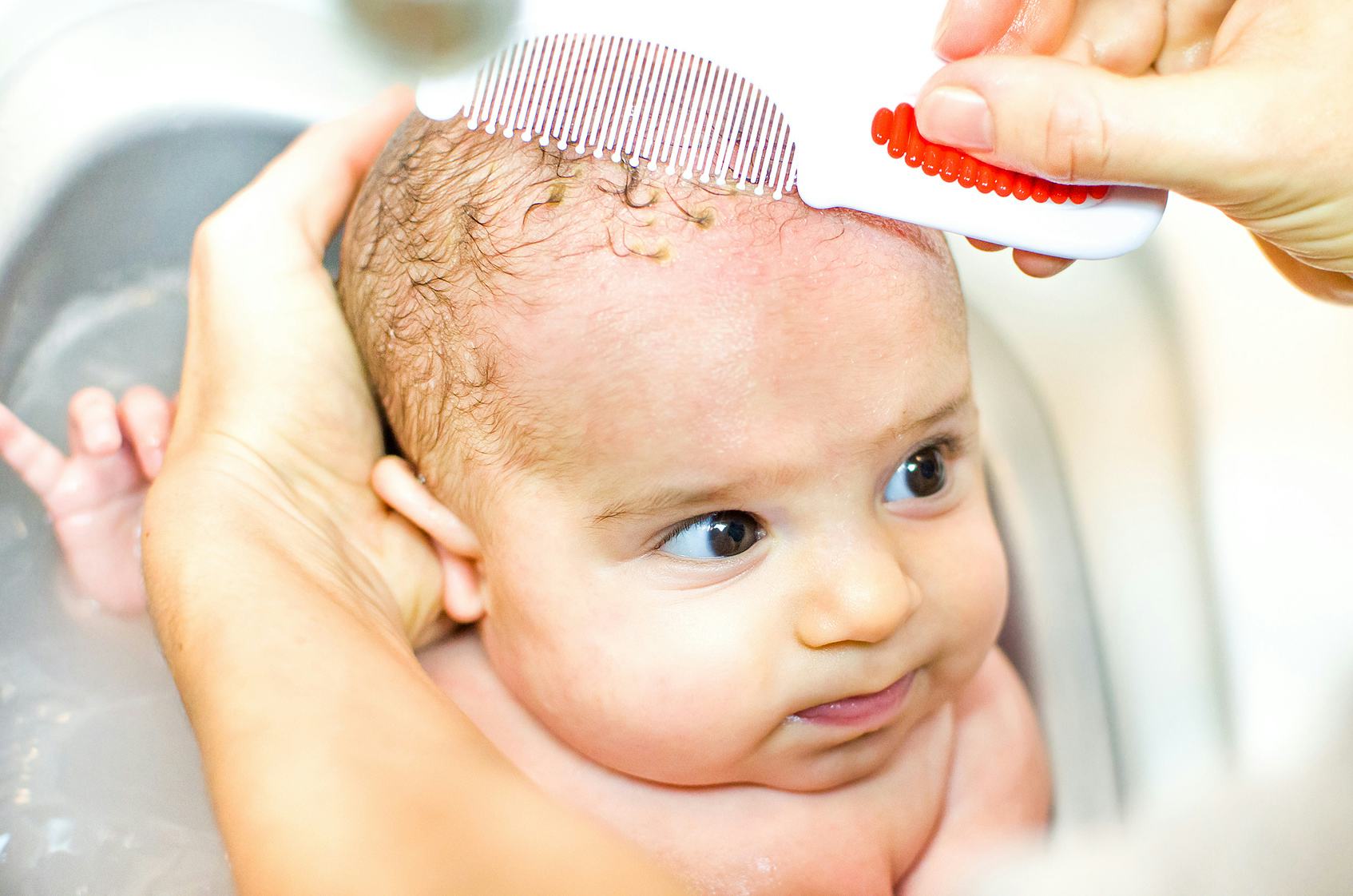How To Treat A Baby Rash, According To Experts