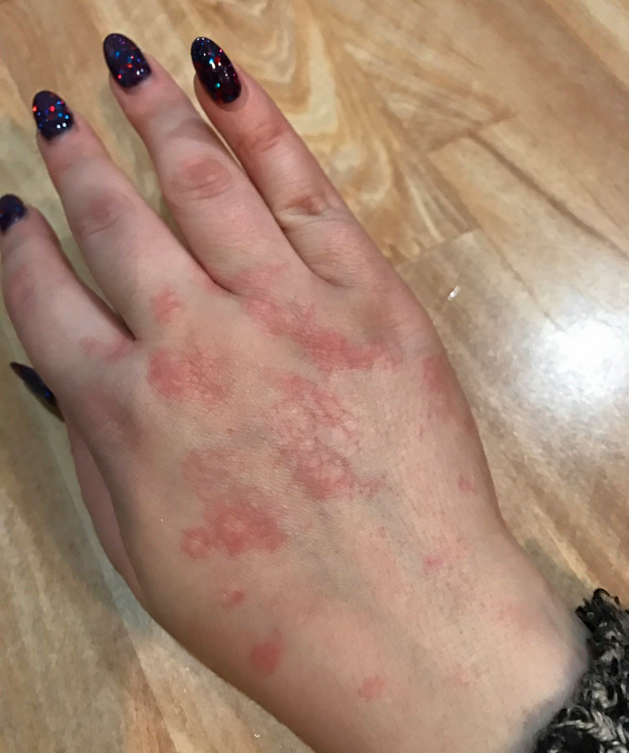 The Best Hand Cream For Dry Skin Soothed My Flaky Fingers & My Soul For ...