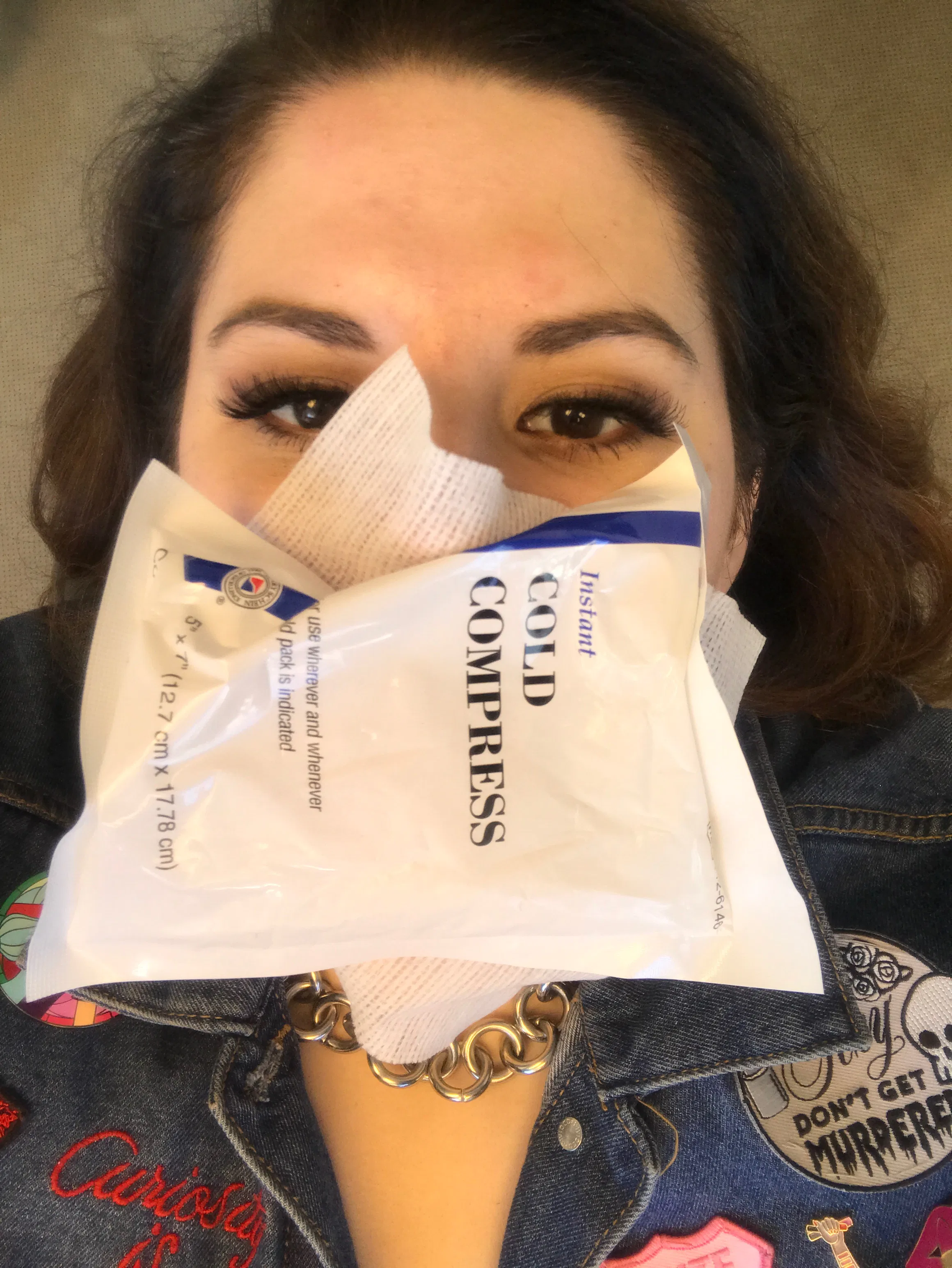 I Got Fillers To Cure RBF & They Actually Turned My Frown Upside Down