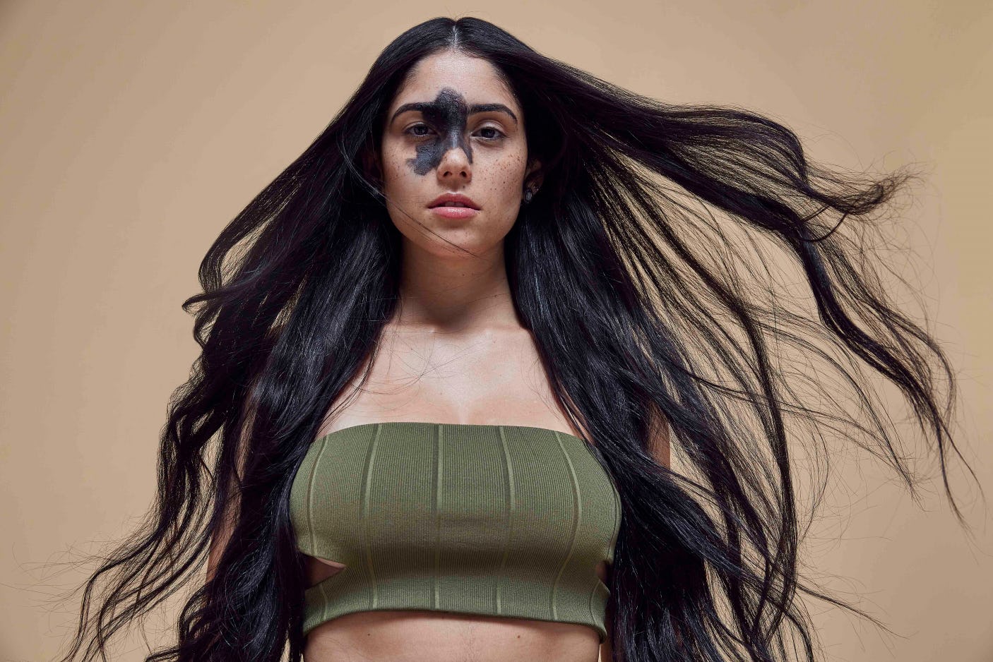 Missguided's #InYourOwnSkin Campaign Celebrates Models With Skin Conditions