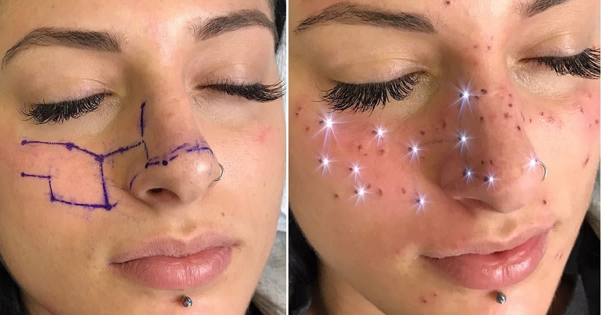 Horns & The Other 7 Most Popular Shocking Body Modifications