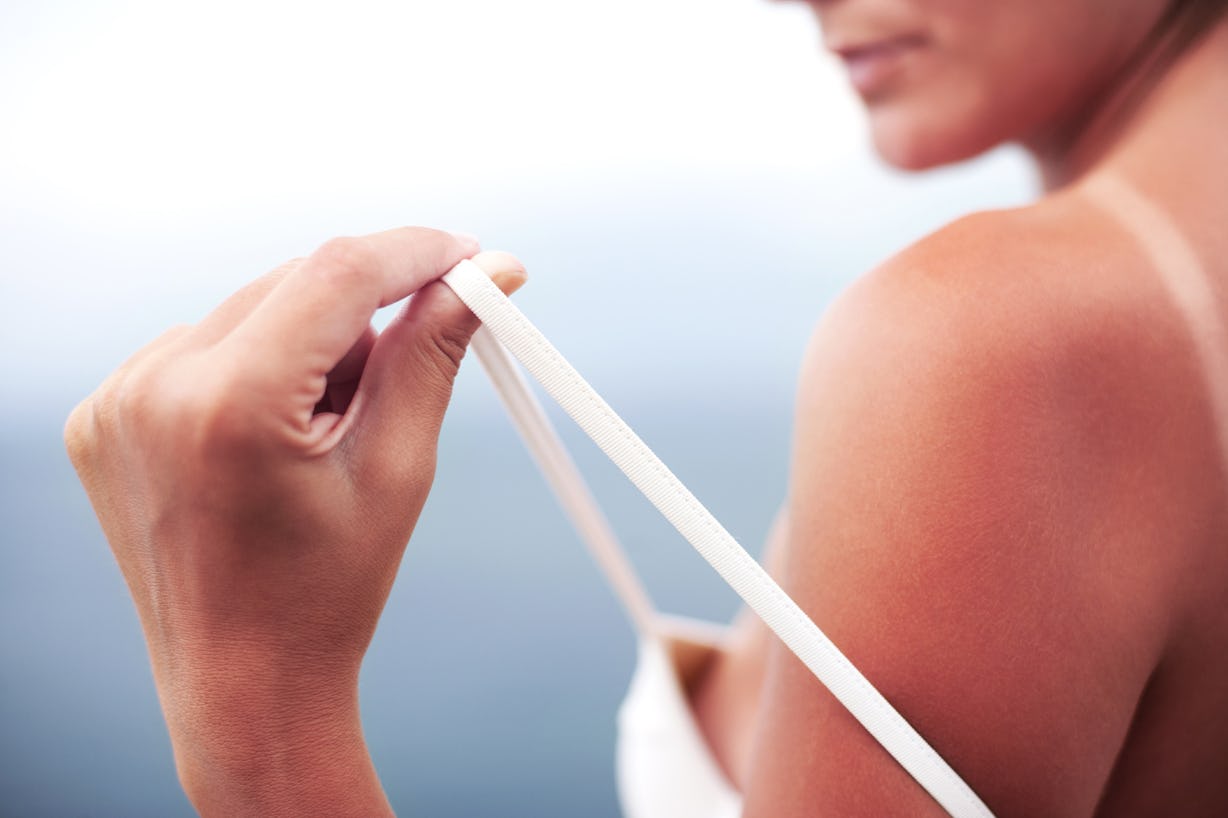 Each Sunburn You Get Increases Your Risk Of Skin Cancer By This Percentage