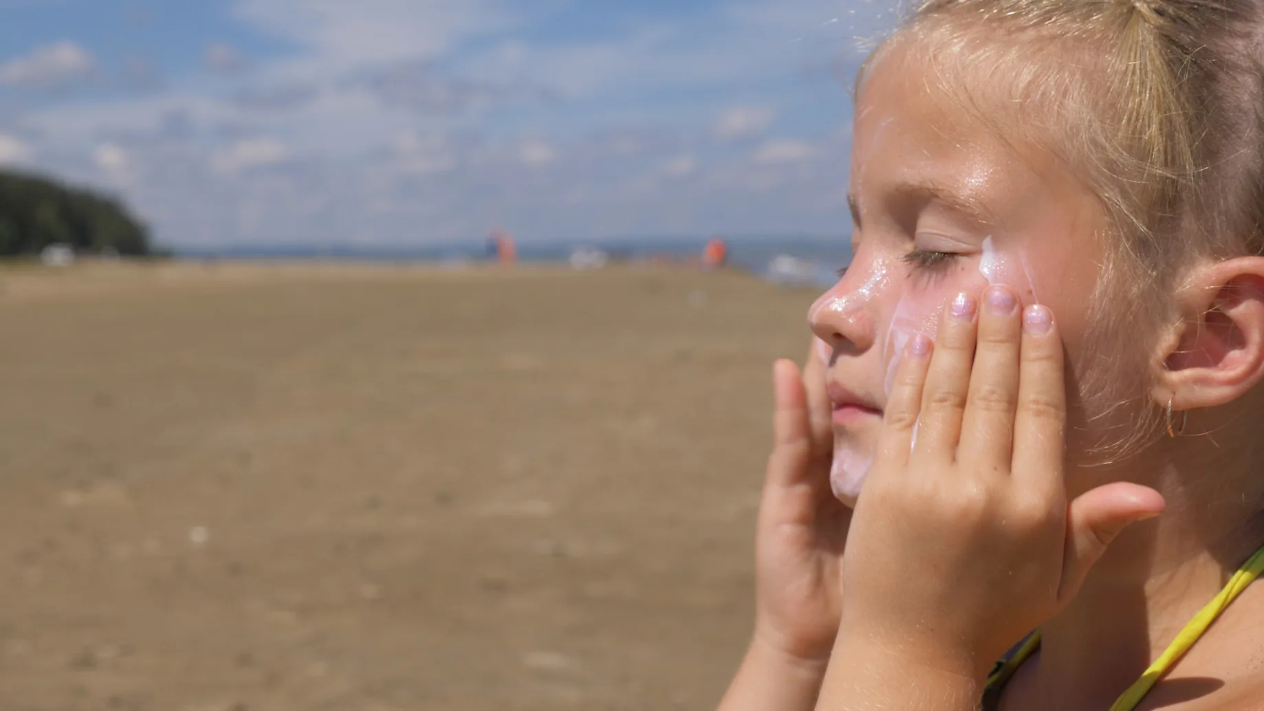 How To Treat Your Kid's Sunburn So They Feel Better Fast