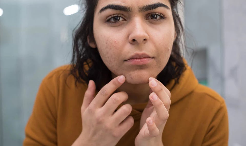 What Does Healthy Skin Look Like? It's A Little More Complicated Than ...