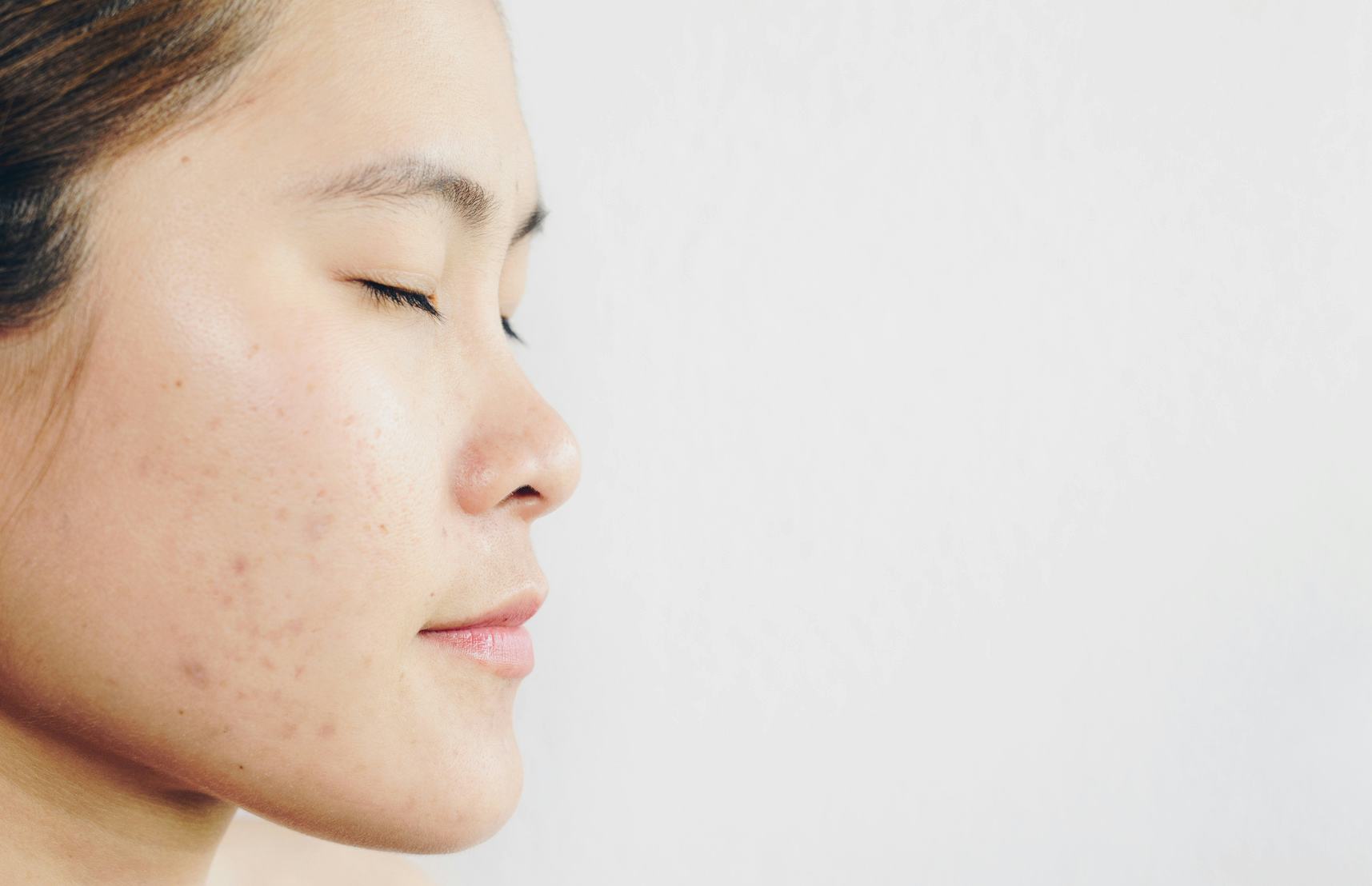 9 Things Your Skin Can Tell You About Your Health