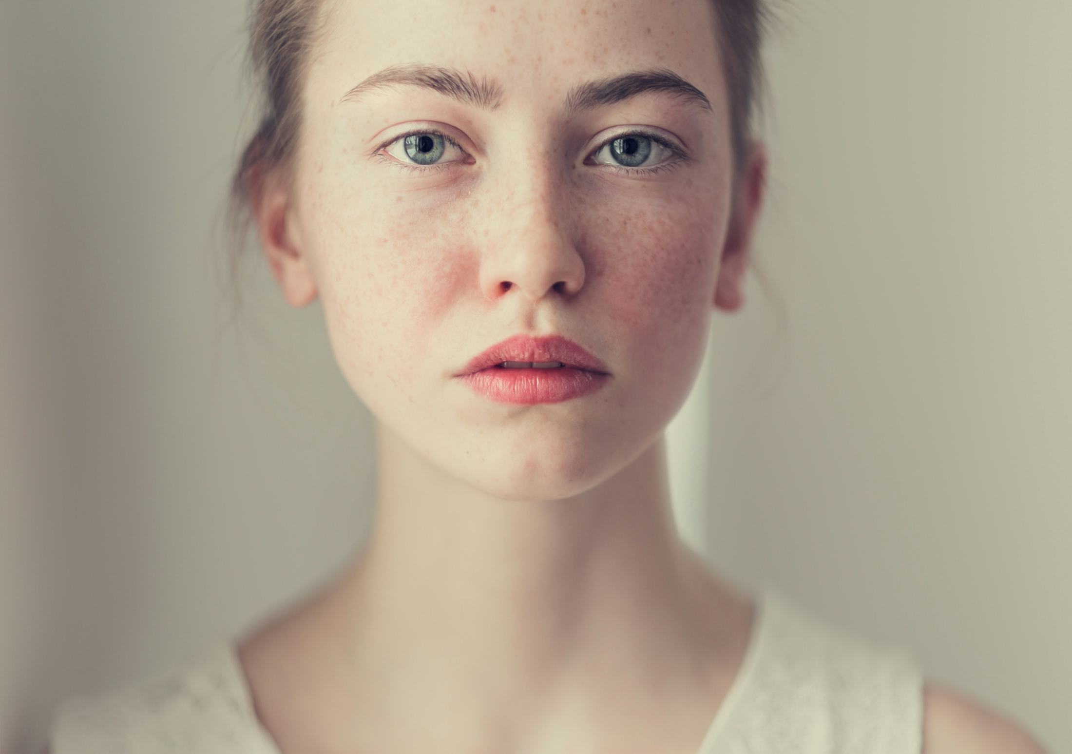 9 Things Your Skin Can Tell You About Your Health