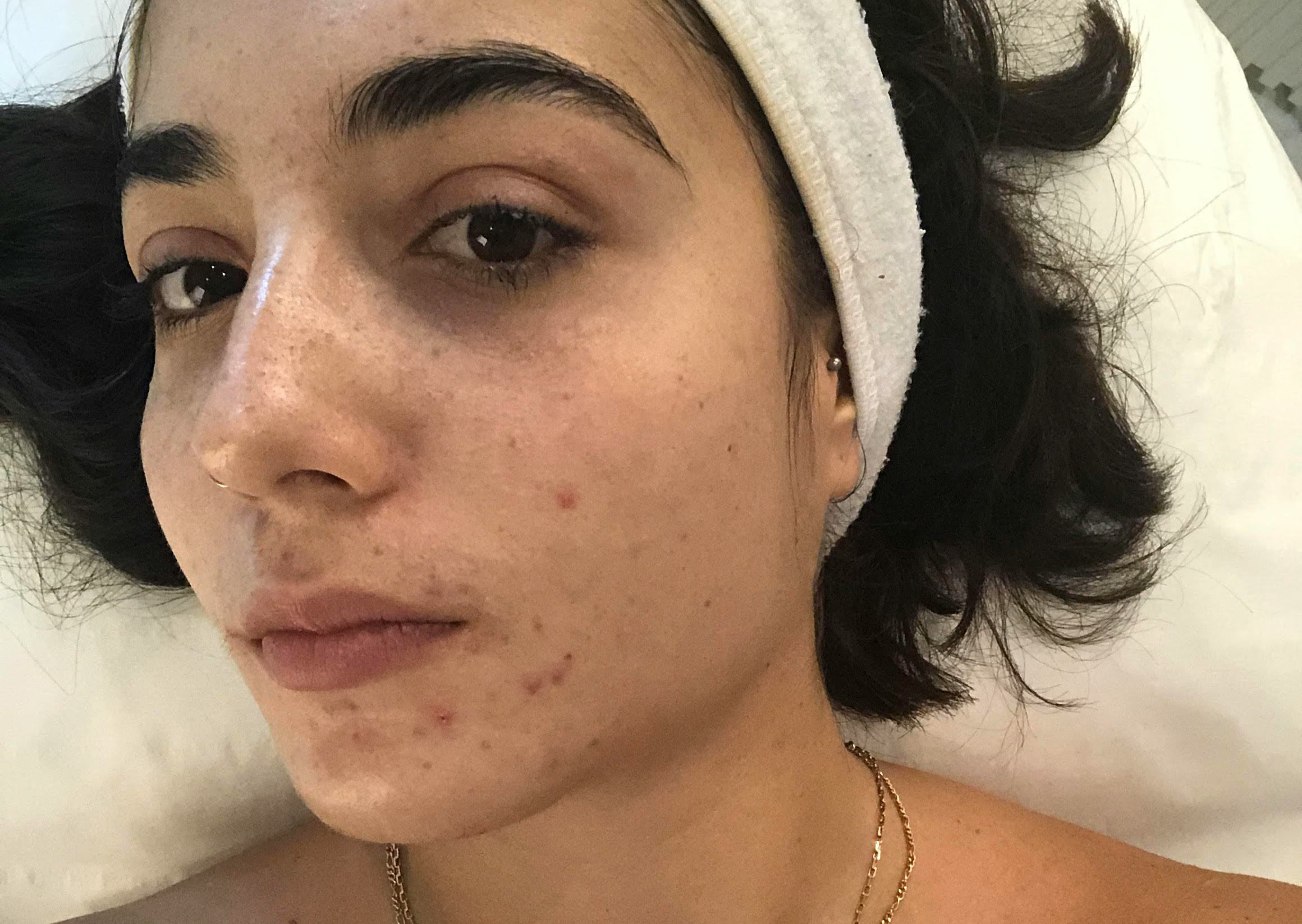 Do AI Skin Apps Actually Work? I Tested Out 5 & Here's What I Found