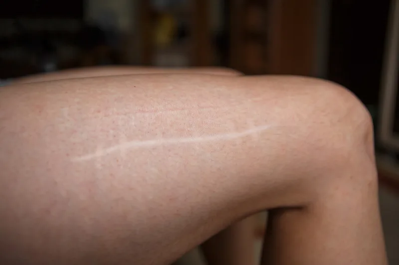 7 Beautiful Photos Of Scars To Make You Want To Embrace Your Own — PHOTOS