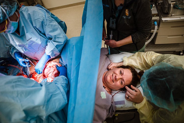 22 C-Section Birth Photos That Prove They're Just As Intense & Powerful ...