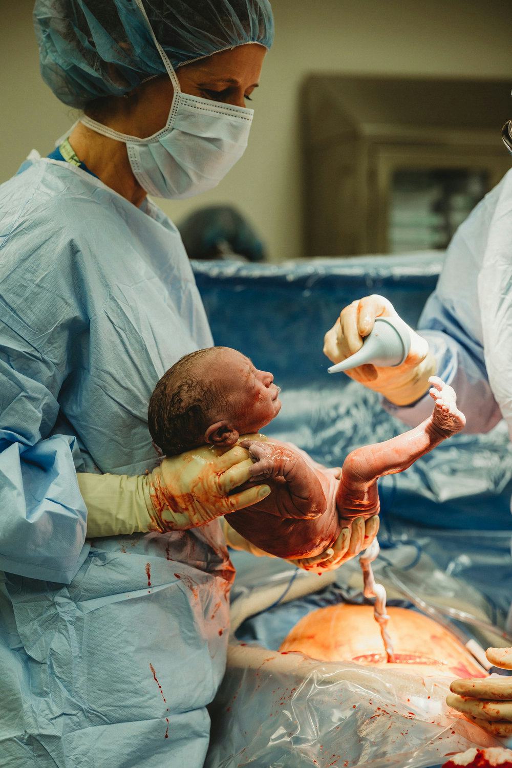 22 C-Section Birth Photos That Prove They're Just As Intense & Powerful ...