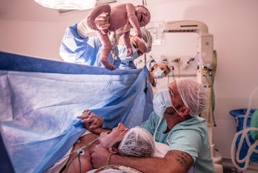 22 C-Section Birth Photos That Prove They're Just As Intense & Powerful ...