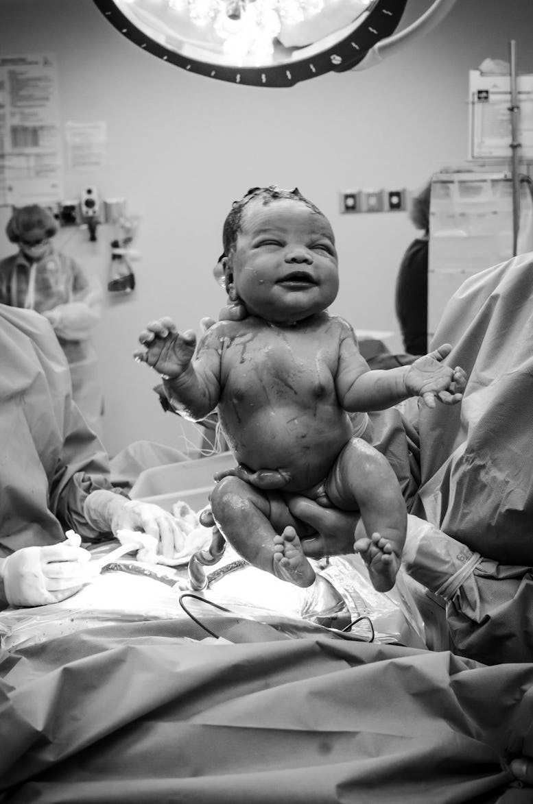 22 C-Section Birth Photos That Prove They're Just As Intense & Powerful ...