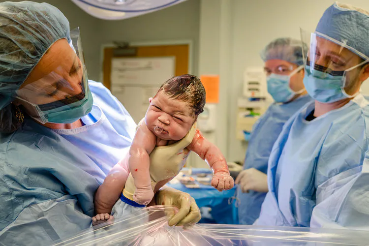 22 C-Section Birth Photos That Prove They're Just As Intense & Powerful ...