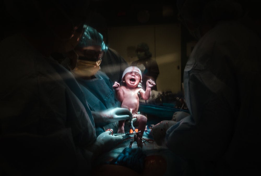 22 C-Section Birth Photos That Prove They're Just As Intense & Powerful ...