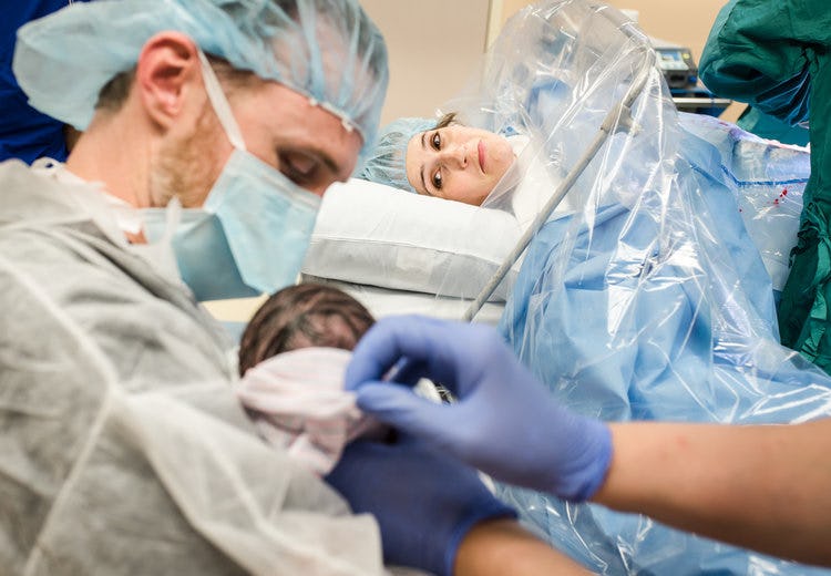 22 C-Section Birth Photos That Prove They're Just As Intense & Powerful ...