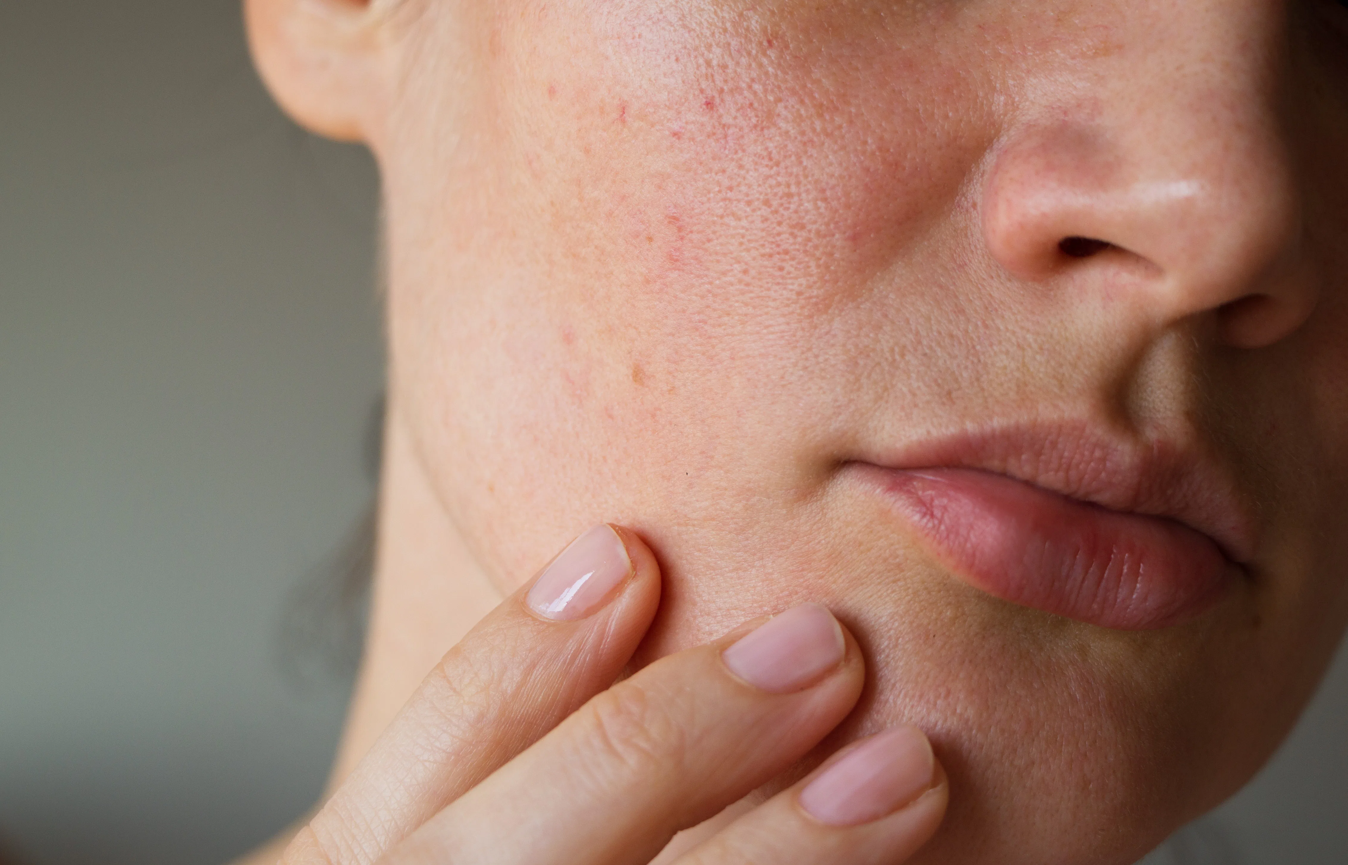 9 Signs Something’s Off With Your Gut That You Can Tell From Your Skin