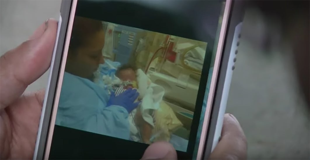 What’s Epidermolysis Bullosa? This Baby Was Born Without Skin