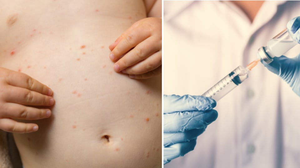 Is A Measles Vaccine Good For Life? Here's How To Know If You're Protected