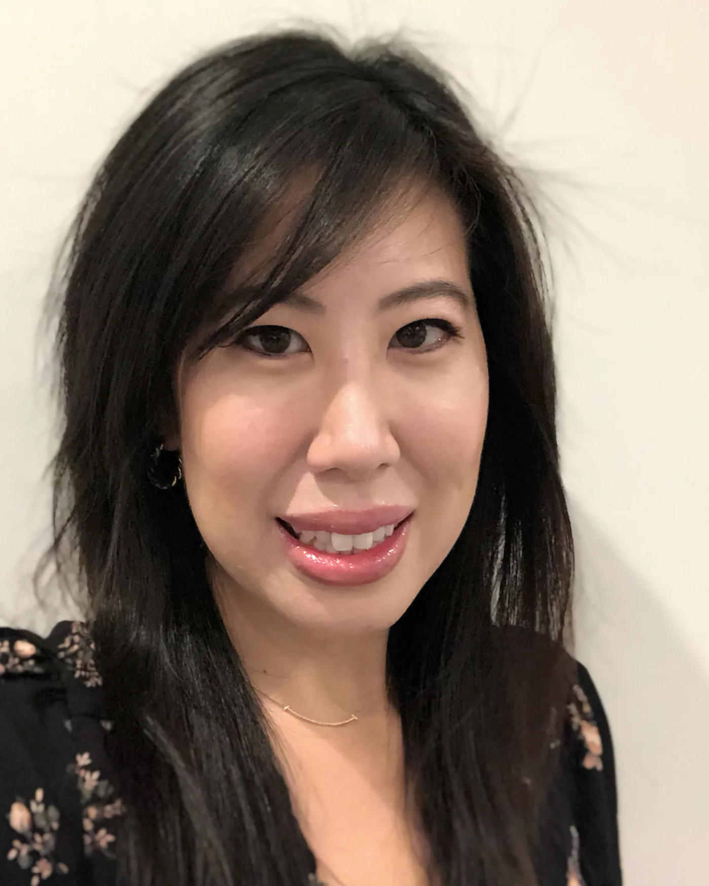 I Got Invisible (Aka Lingual) Braces As An Adult & I Noticed A Shift In ...