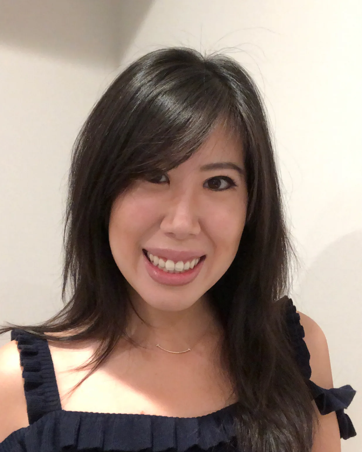 I Got Invisible (Aka Lingual) Braces As An Adult & I Noticed A Shift In ...